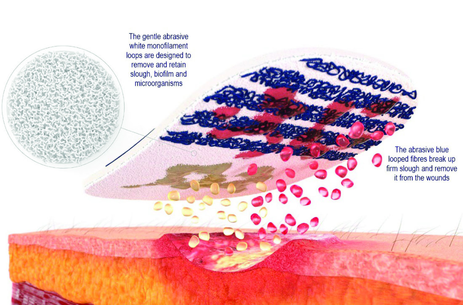 Equine Mud Fever - National Veterinary Services